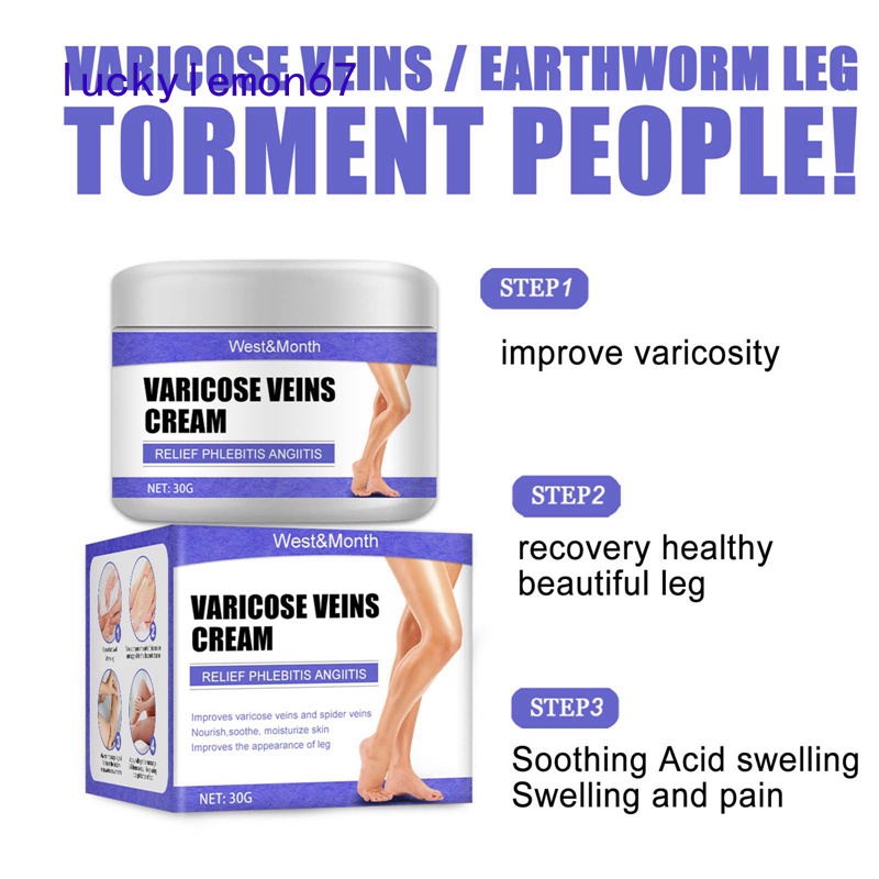 Vein repair cream Vein cream leg varicose earthworm leg blue tendon ...