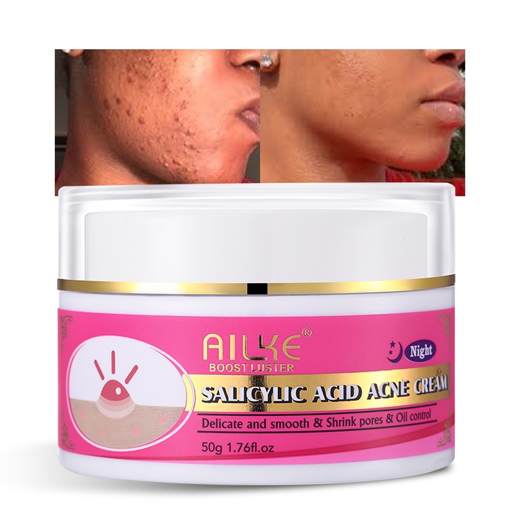 AILKE 50g Private Label Acne Treatment Moisturizing Salicylic Acid ...