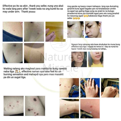 Nunal Memes Essensa Naturale BUAH Wholesalers MERA Mix