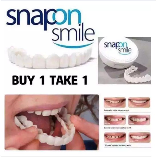 Buy 1 take 1 Snap on Smile Teeth Veneer (up and down) ESAME | Shopee ...