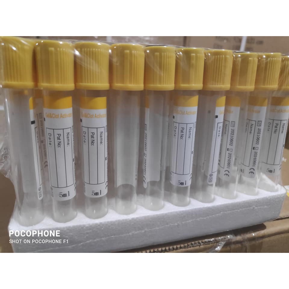 5mL yellow Glass Serum Separator Tube 13x100 long type with gel clot ...