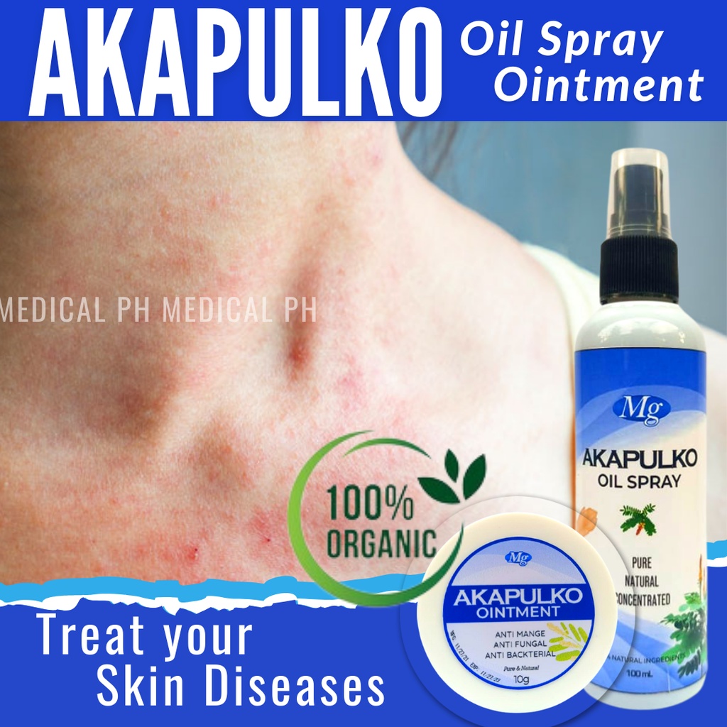 [MEDICAL PH] Magnesium Akapulko Oil Spray and Ointment Treat Fungal ...