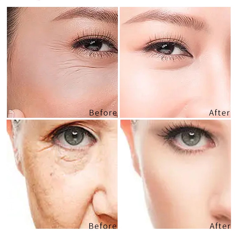 GZE Retinol Essence Toner Dark Spot Remomval Anti Wrinkle Anti-Aging ...