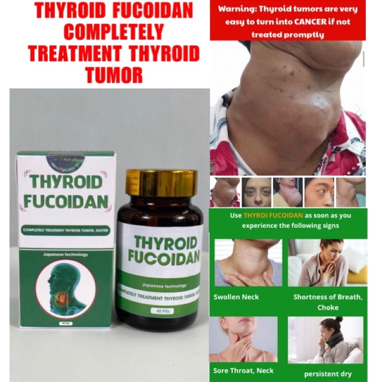 THYROID FUCOIDAN COMPLETELY TREATMENT THYROID TUMOR 100% ORIGINAL ...