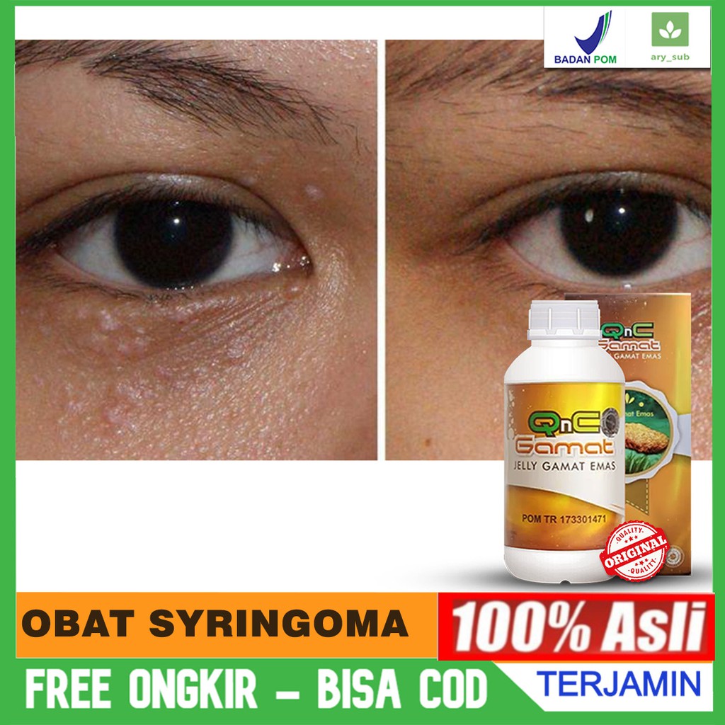 MATA Syringoma Medicine Around the Eyes - Cheeks - Neck - Chest ...