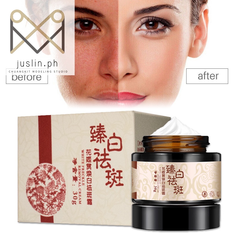 Whitening And Freckle Removing Cream Quick Spot Removal Whitening ...
