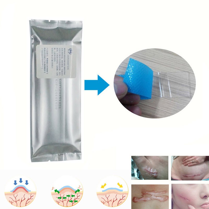 Silicone Removal Patch Reusable Acne Gel Scar Therapy Silicon Patch ...