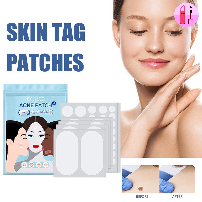 Invisible Acne Treatment Patch / Pimple Anti-inflammatory Stickers Set ...