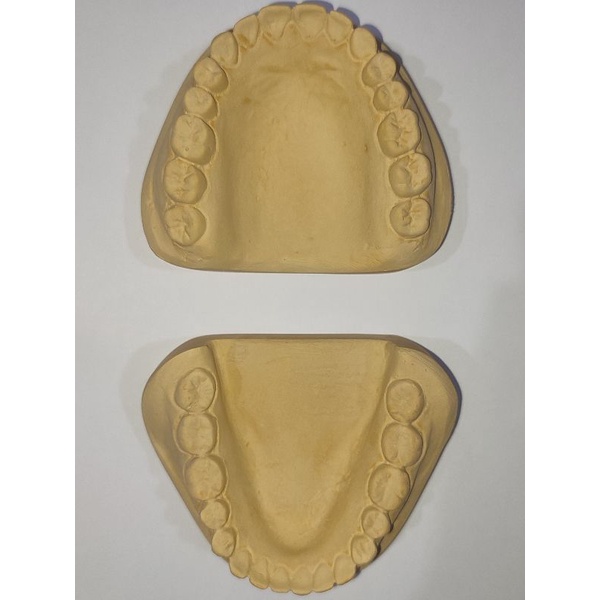 RPD Patient's Cast for Boards | Shopee Philippines