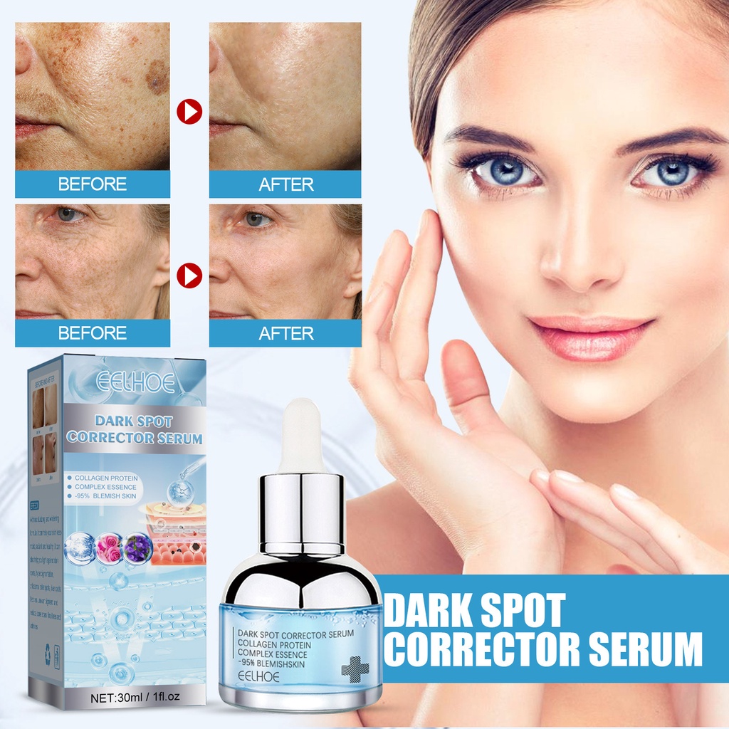 Eelhoe Sheep Placenta Collagen Essence Hydrating and Brightening ...