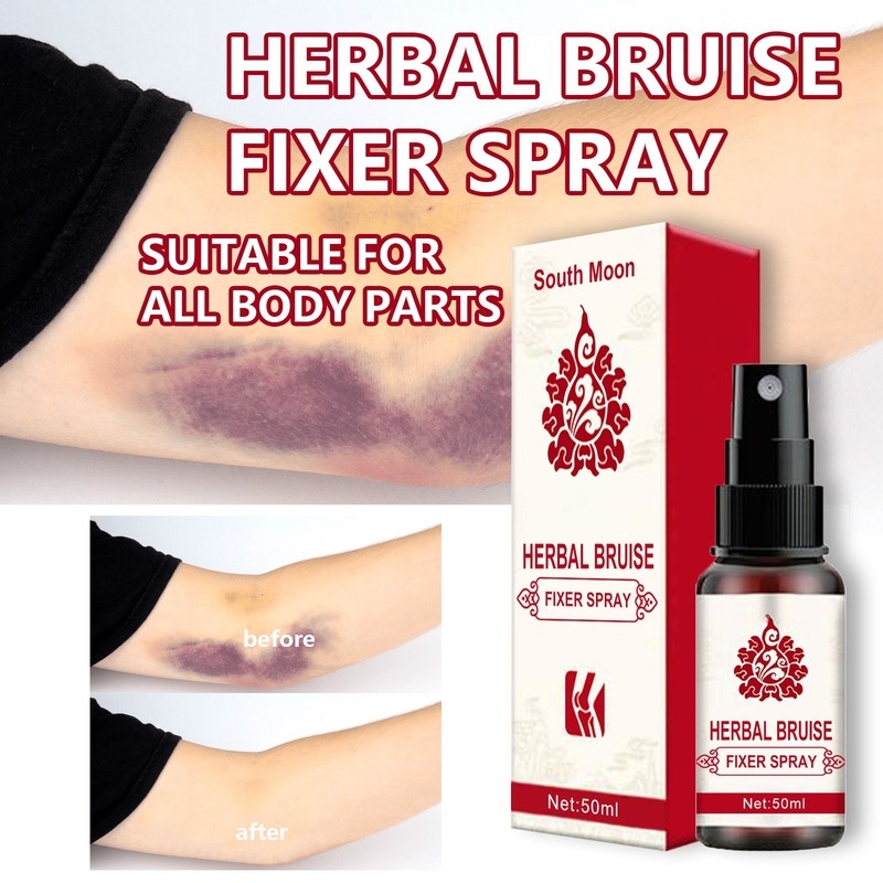Herbal bruise spray sports sprain muscle strain bruise spray ankle knee ...