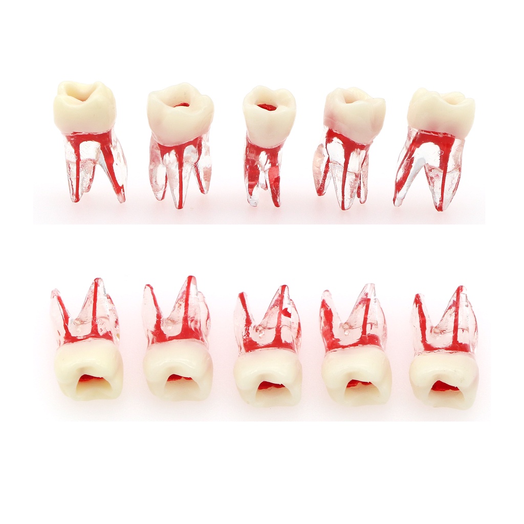 Dental Root Canal Teeth Model Endodontic File RCT Practice Block Pulp ...