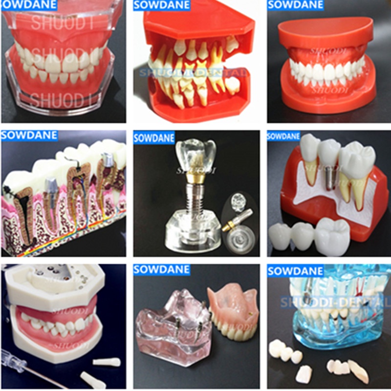 Dental Study Teaching Model Dental Impant Standard Model Removable ...