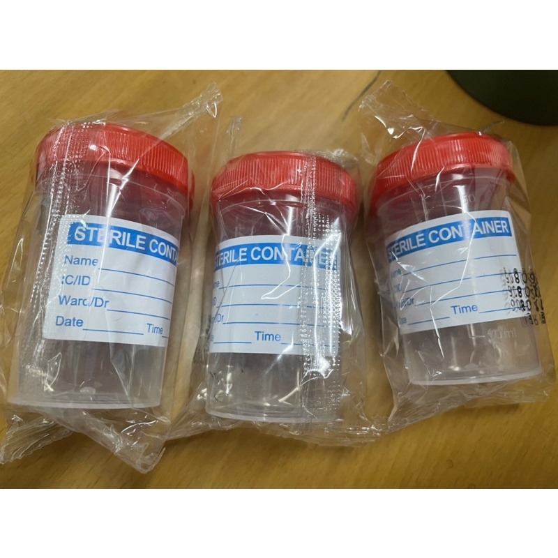 Sterile Urine stool specimen container with label individual packed ...