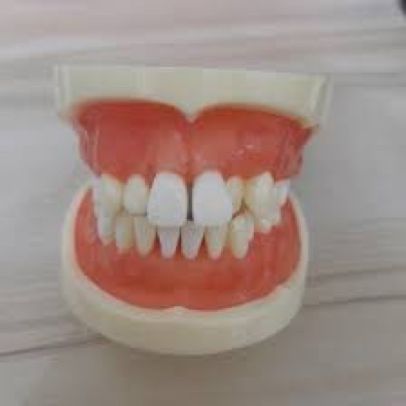 Adult Typodont Generic Articulator/ Jaw Model (Same with Nissin and ...