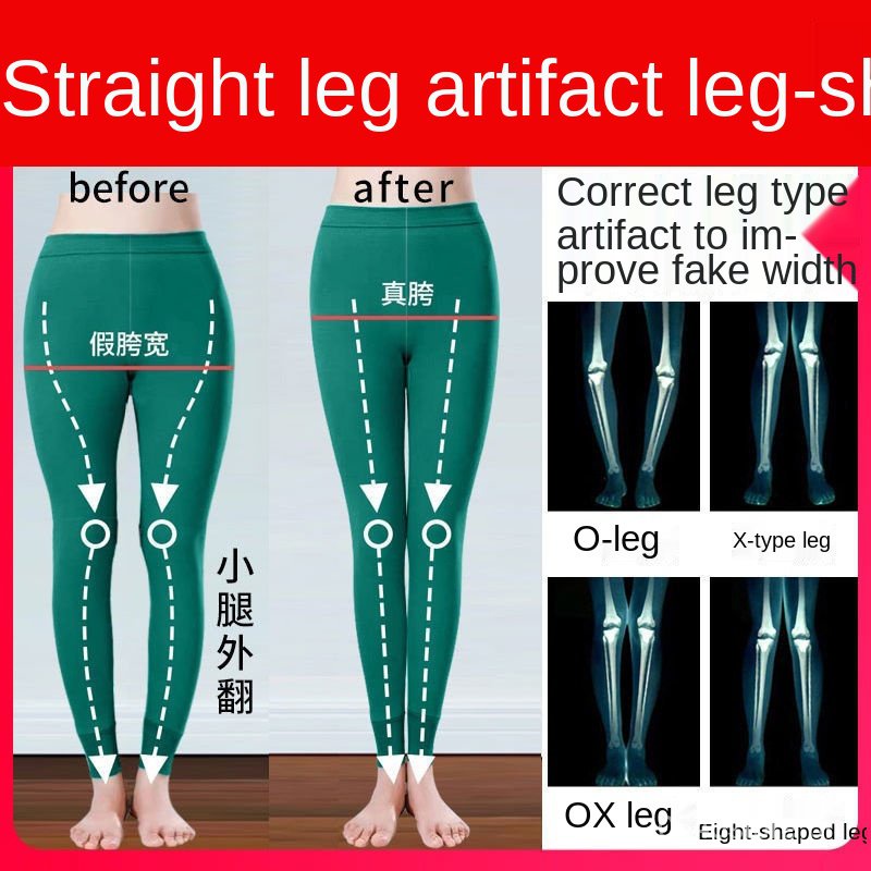 O-leg, X-leg orthosis Injury and sprain protection Leg straps Bow ...