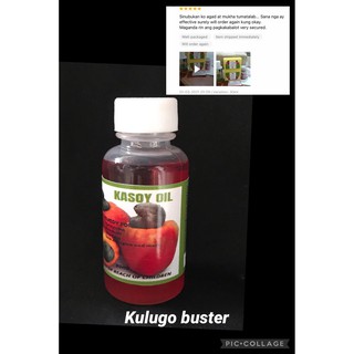 Kasoy oil 30ml Pantanggal ng kulugo/Buni/ An an | Shopee Philippines