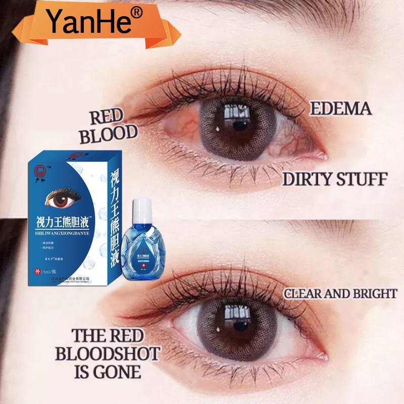 【Spot goods】Eye Drops for Eye Care15ml/Brand Eye Drops/mineral eyedrops ...