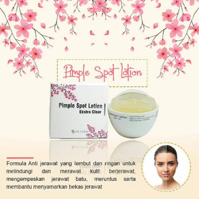 Pimple Spot Lotion Ms Glow | Shopee Philippines