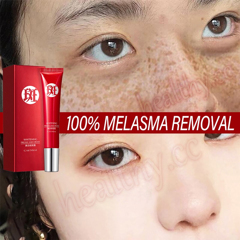 Melasma Cream Whitening Freckle Cream dark spots Pekas Remover Cream ...
