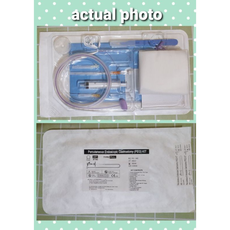 PEG Tube Pull type Gastrostomy Tube Kit | Shopee Philippines