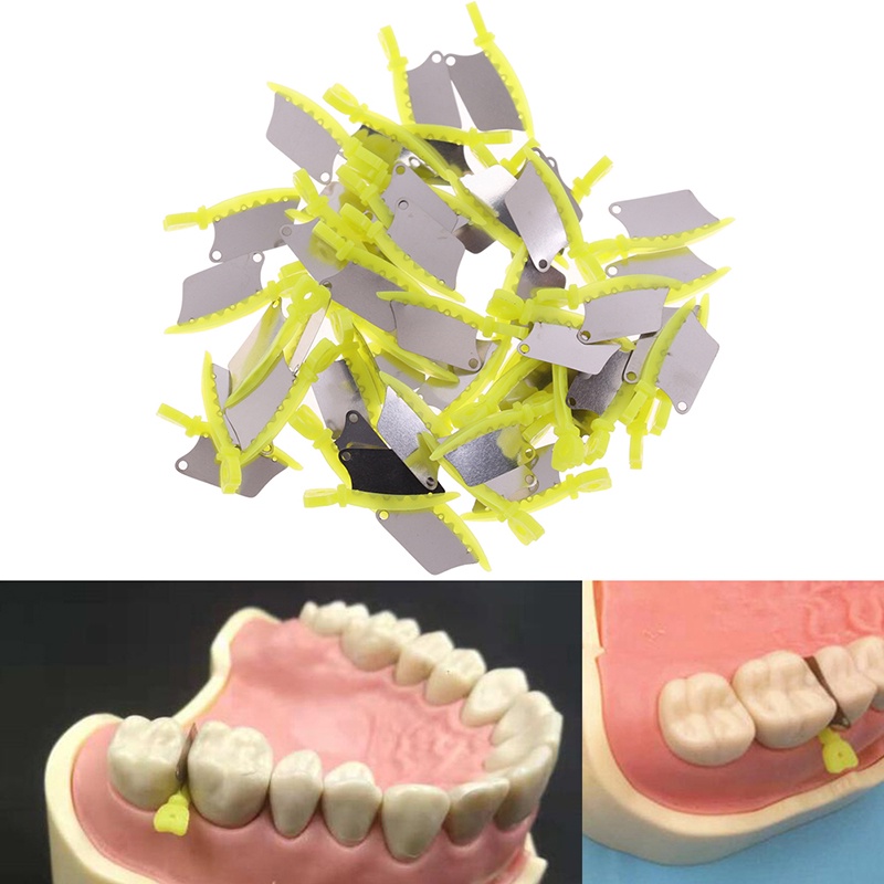 50X Dental Prime Teeth Interproximal Plastic Wedge Knife Protection ...