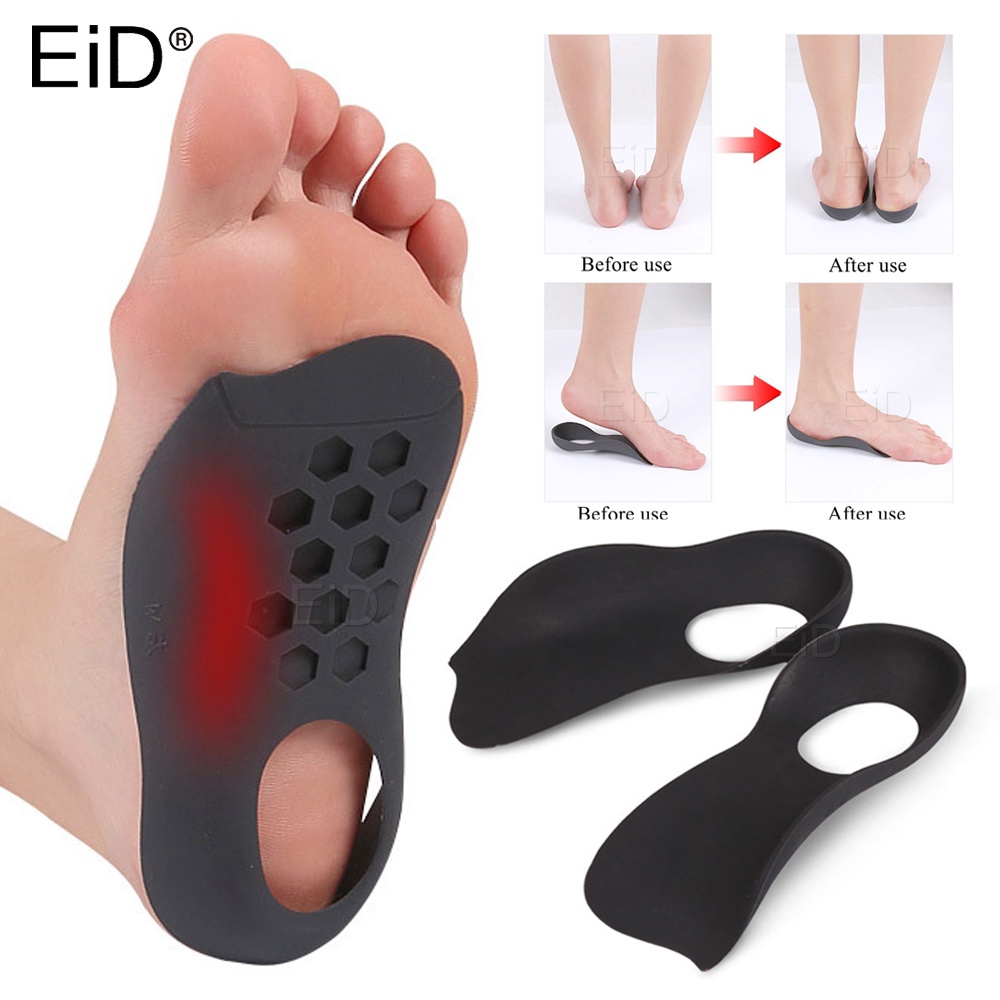 XO-Legs Orthopedic Insoles Orthotics Flat Foot Health Sole Pad For ...