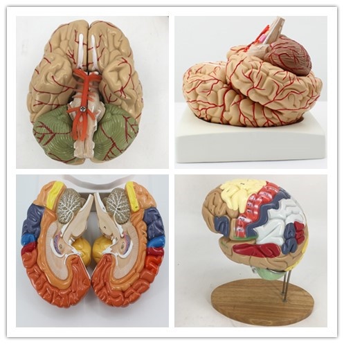 detachable Human brain anatomy model cerebrovascular brain model ...