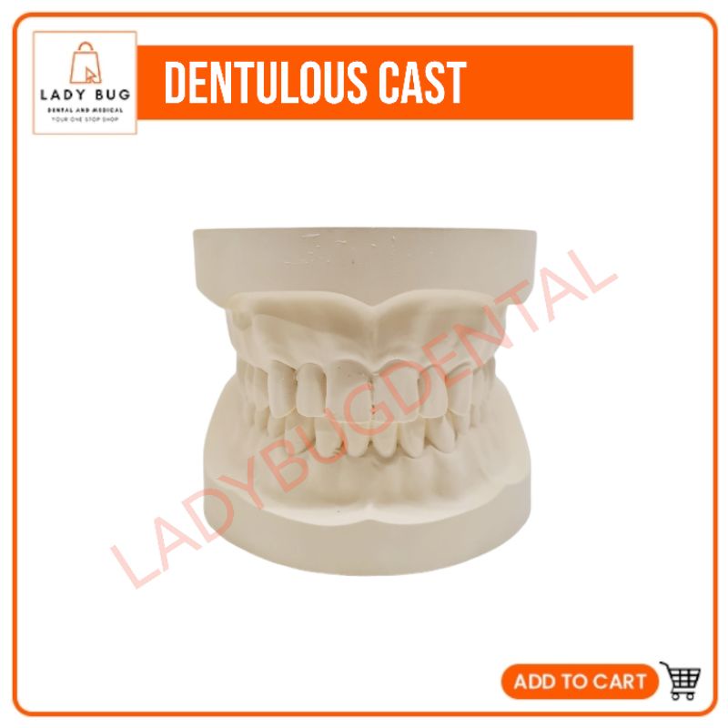 Dentulous/ Ideal/ Nissin Cast | Shopee Philippines
