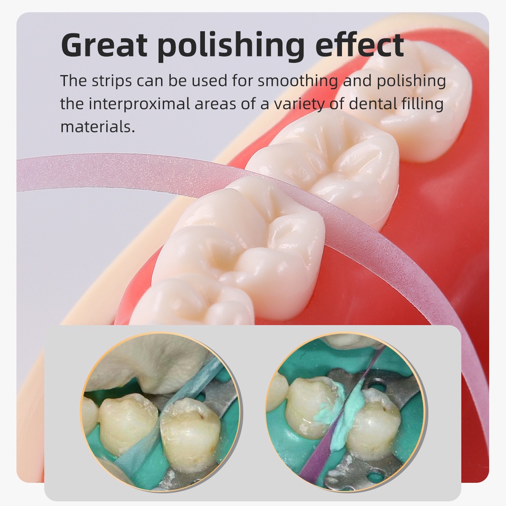 Dental Polishing Smoothing The Interproximal Strip Three Color 4mm Wide ...