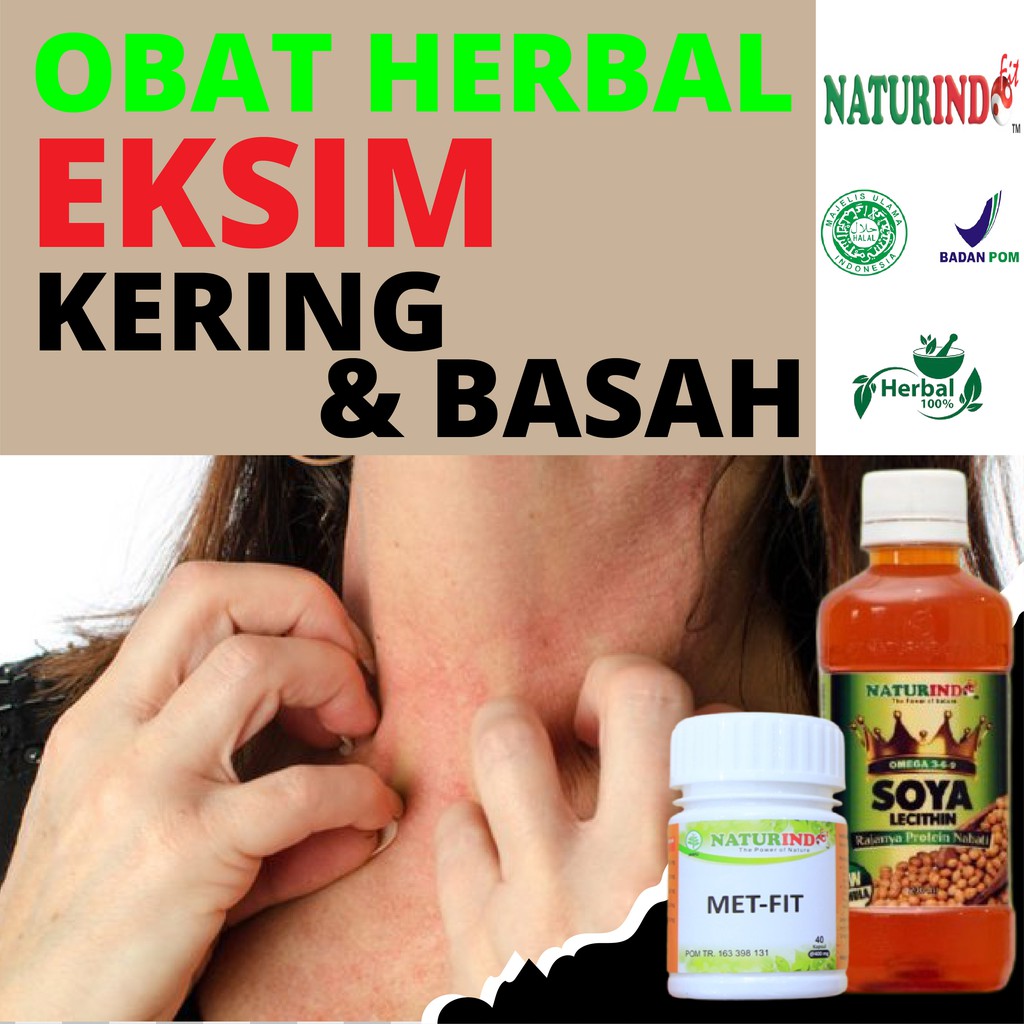 Eczema Medicine For Wet Dry Skin Atopic Itchy Hands Feet Scaly Menahun ...