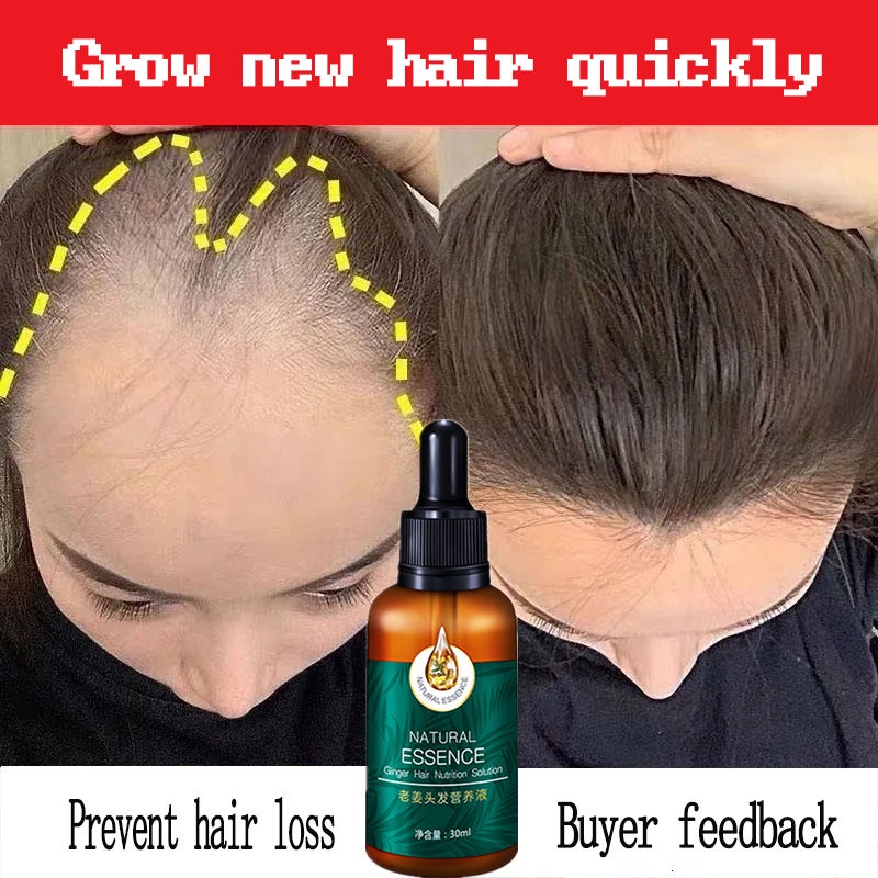 7x Rapid Growth Hair Treatment Anti Hair Loss Fast Hair Growth Serum