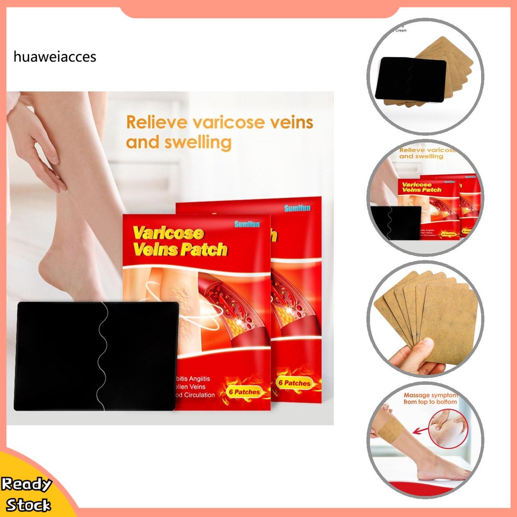 HUA Natural Varicose Veins Sticker Vasculitis Phlebitis Treatment Patch ...