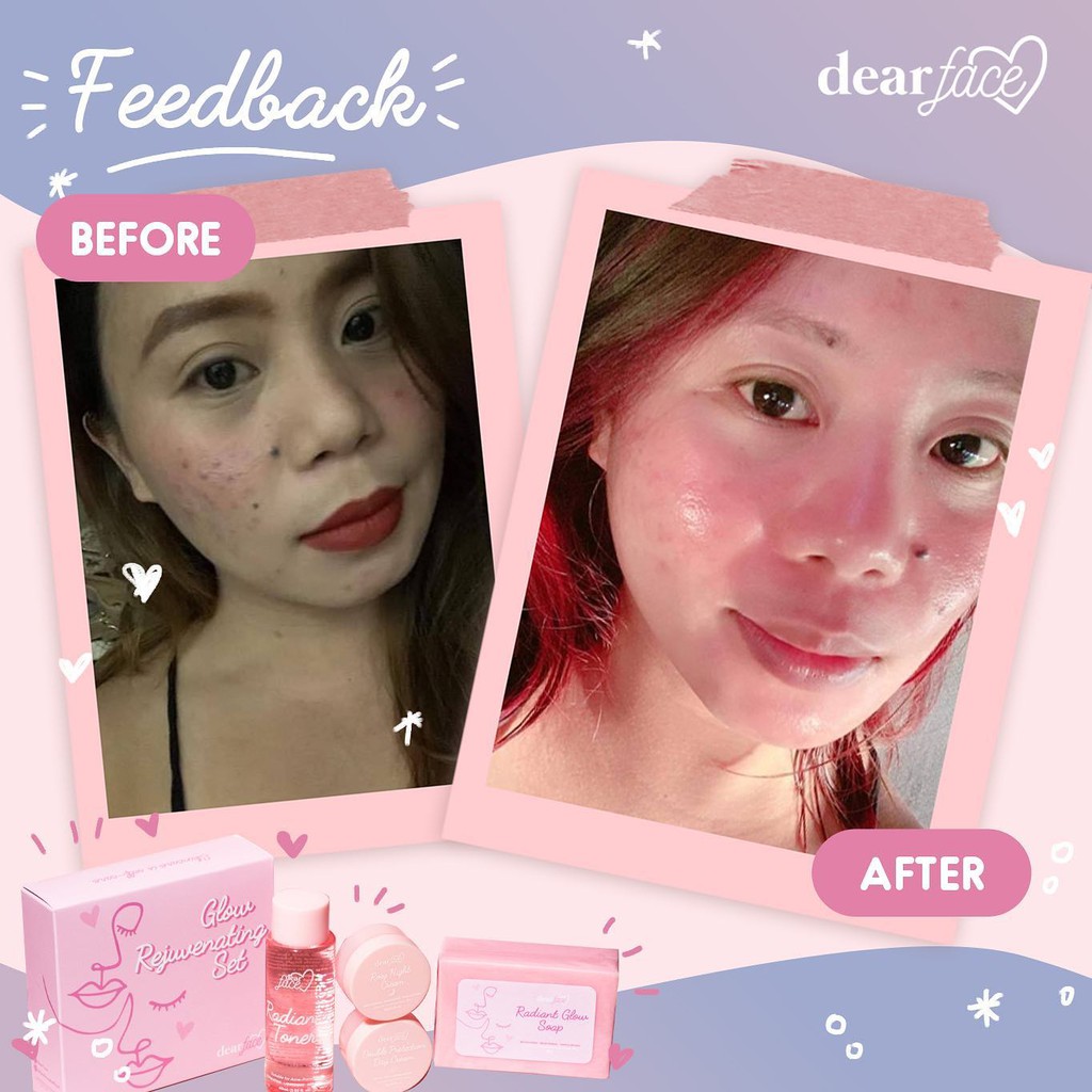 Dear Face Whitening and Rejuvenating Set | Shopee Philippines