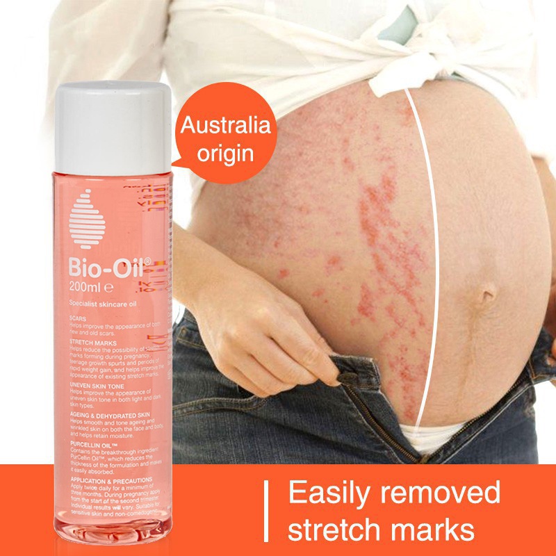 Bio-Oil Skincare for stretch marks treatment scar remover acne ...