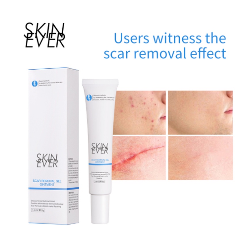 SKIN EVER Acne Treatment Cream Repair Skin Scar Removal Pimple Mark ...