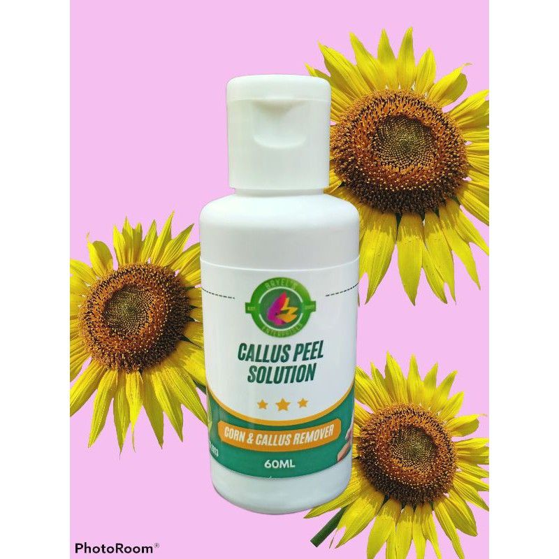 Kalyo Peel/Callus Peel Remover/Callus Peel Solution 60ml | Shopee ...