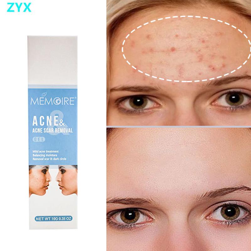 Herbal Acne Removal Face Cream Oil Control Anti-Acne Gel Treatment Acne Mark Skin Care Whitening ...