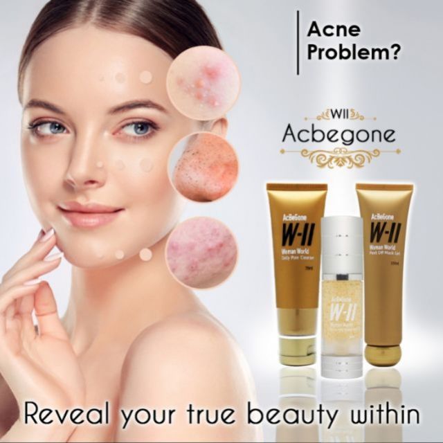 Original WII New AcBeGone Set | Shopee Philippines