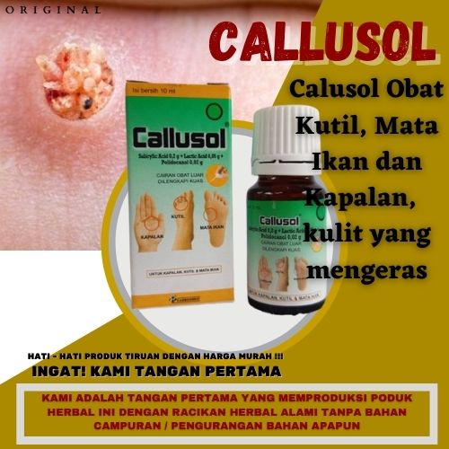 MATA GHA | CALLUSOL FISH EYE MEDICINE Warts Calluses Dry And Cracked ...