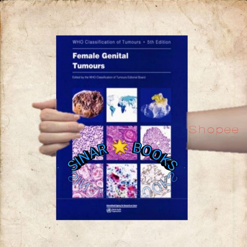 WHO classification of female genital tumours 5th Fifth Edition | Shopee ...