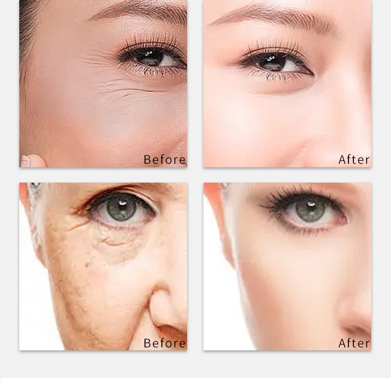 GZE Natural Retinol Cream For FACE Anti Aging Whitening Reduce Wrinkles ...