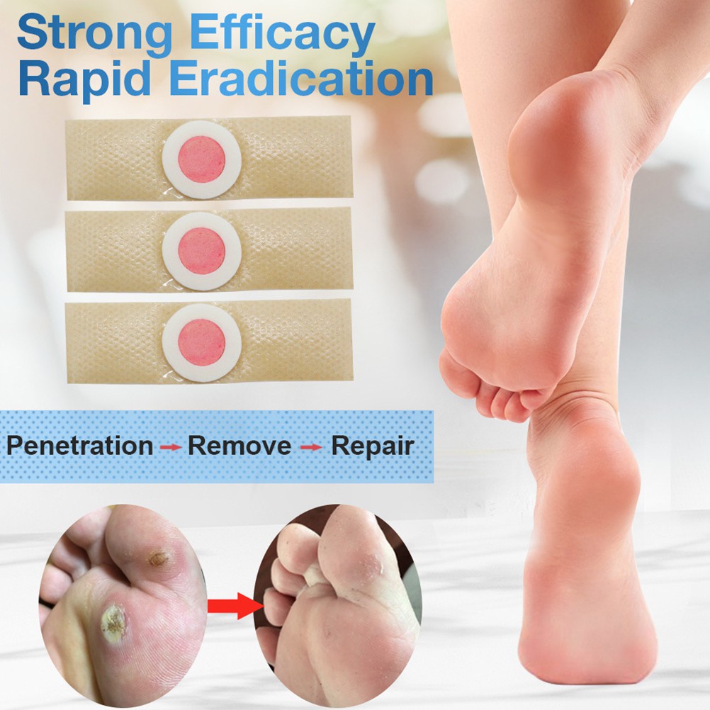 [READY STOCK] Pcs Remove Corns Stickers Plantar Patches Remover Pads ...
