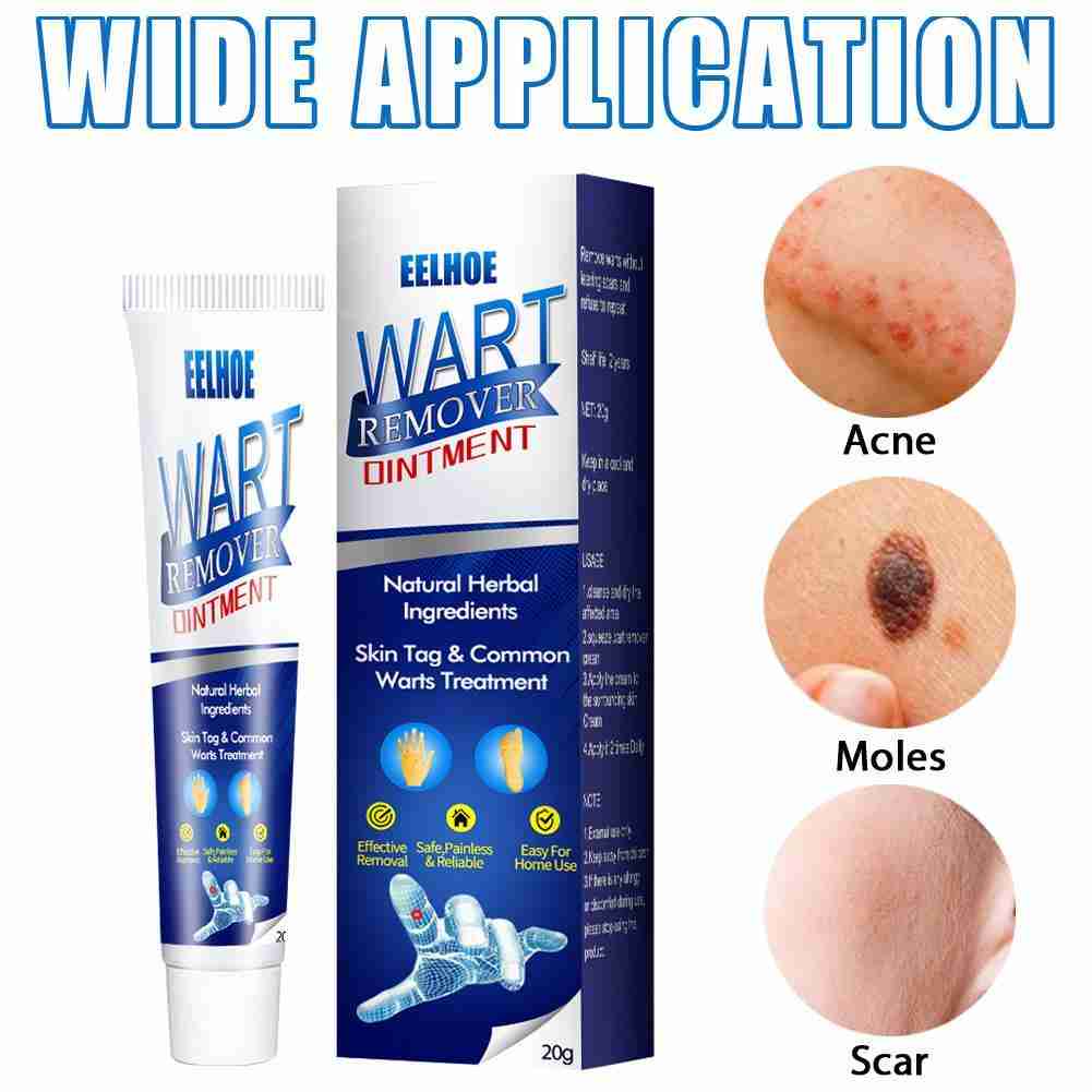 Warts Remover Original Cream Wart Removal Ointment Wart Treatment Skin ...