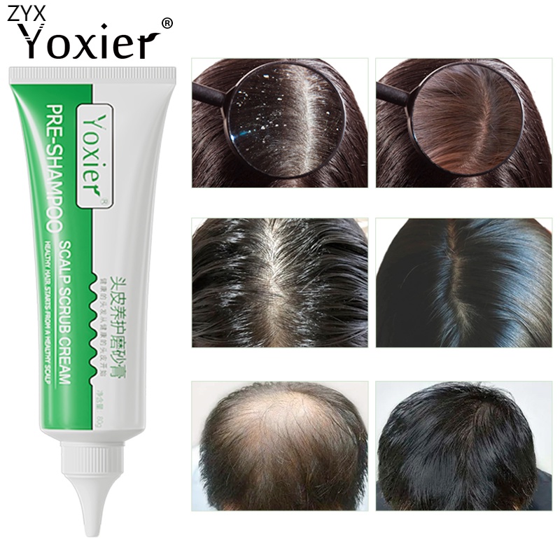 Yoxier Hair Thinning Loss Products Pre-Shampoo Scalp Scrub Nourish ...