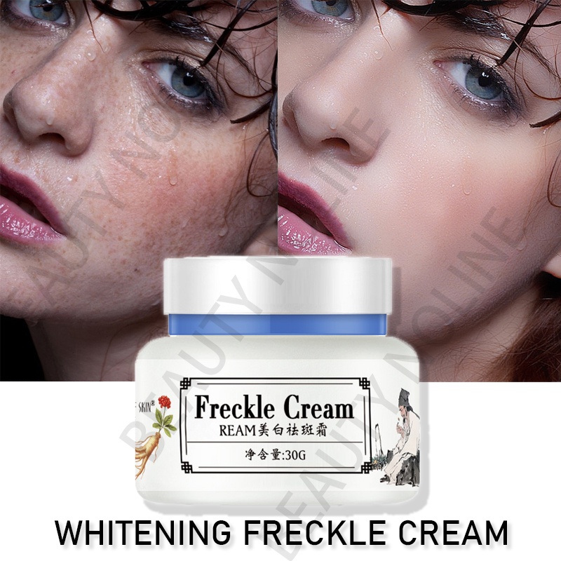 Freckle Cream Whitening remove dark spots and fade melasma Brighten ...