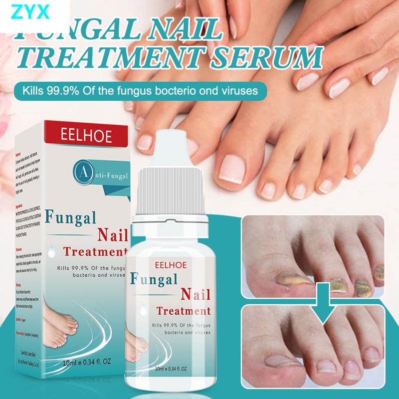 Fungal Nail Treatment Serum for Toenails Fingernails Promote New Growth Nail Fungus Repair ...