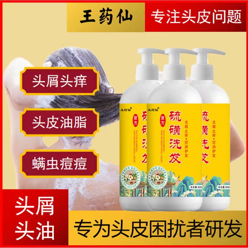 Wang Yaoxian Sulfur Shampoo/Fat Overflowing Dermatitis/Anti-Dandruff ...