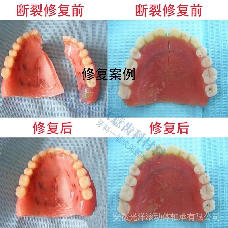Movable Denture Glue Dentures Falling Off Sticky Teeth Broken Fixed Repair Adhesive cxbahgxgdt ...