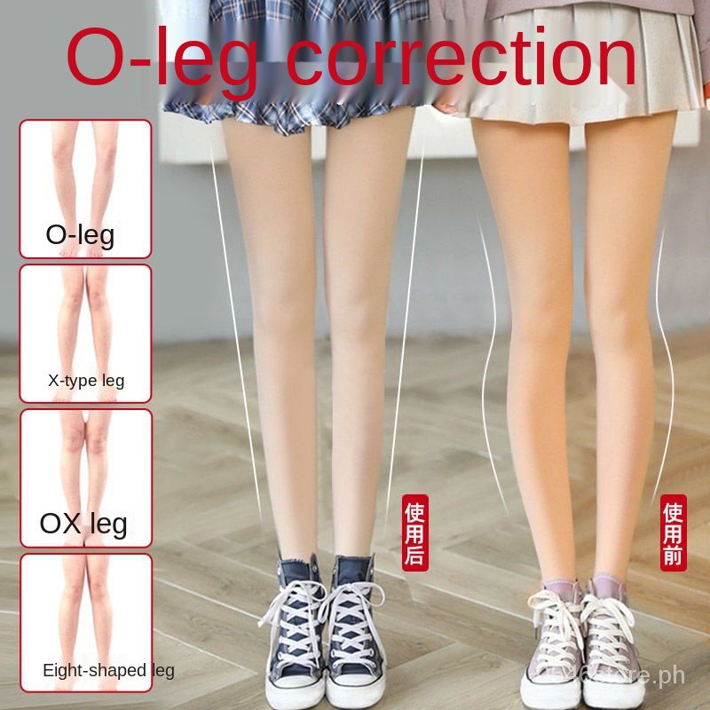 O-leg, X-leg orthosis Injury and sprain protection Leg straps Bow ...